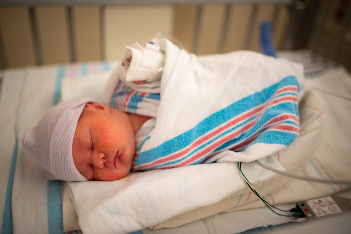 A miracle is born! Baby to receive a first-of-its-kind surgery - The ...