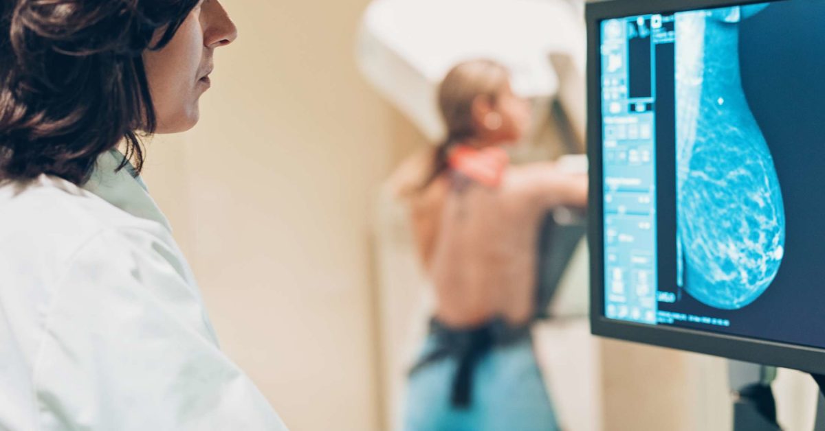 Artificial intelligence tool improves accuracy of breast cancer imaging ...