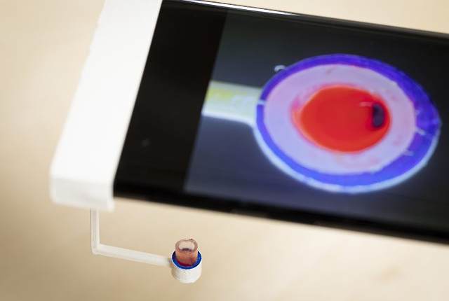 New smartphone app accurately tests how well blood clots - The Brighter ...
