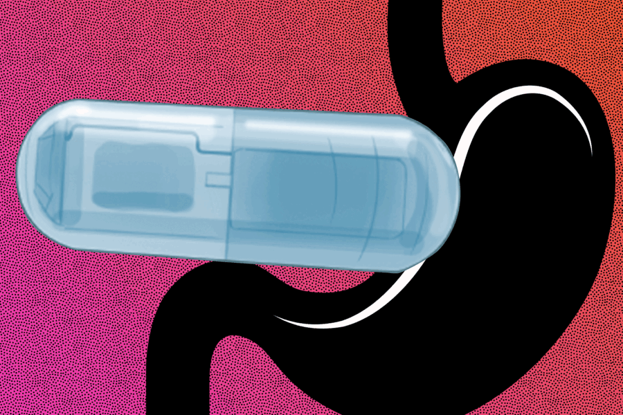 Scientists develop easy-to-swallow capsule to combat obesity - The ...