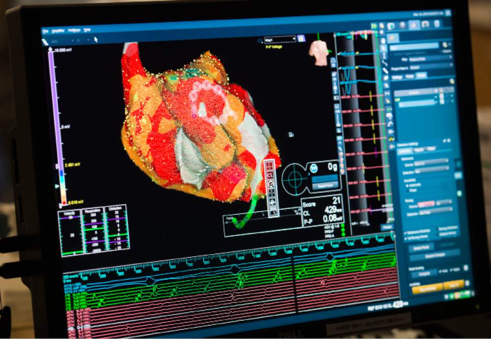 Ultra-precise human heart map can even pinpoint where heartbeats come ...