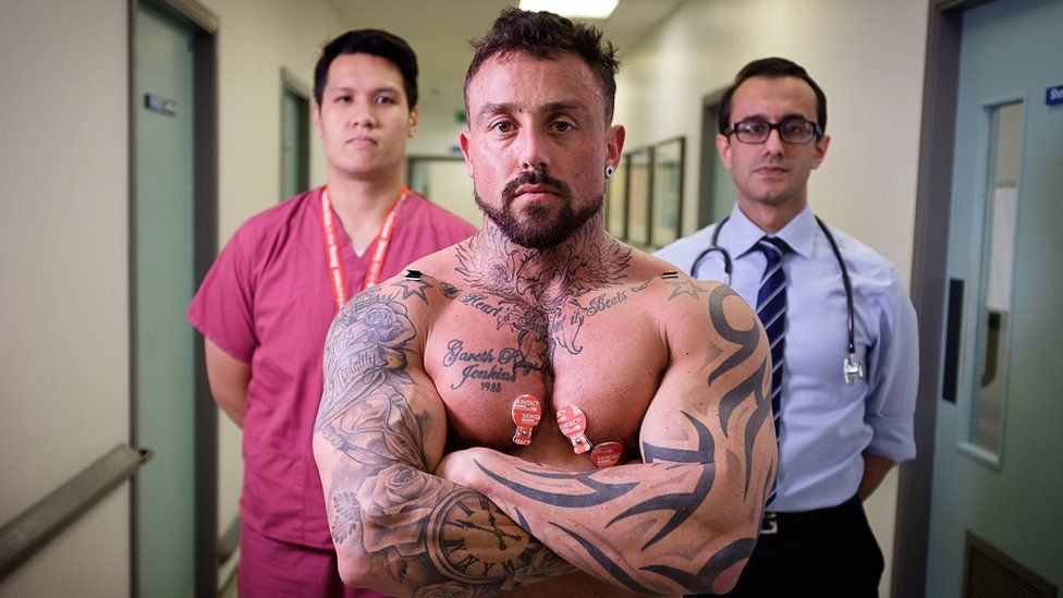 Groundbreaking research links steroids and heart disease - The Brighter ...