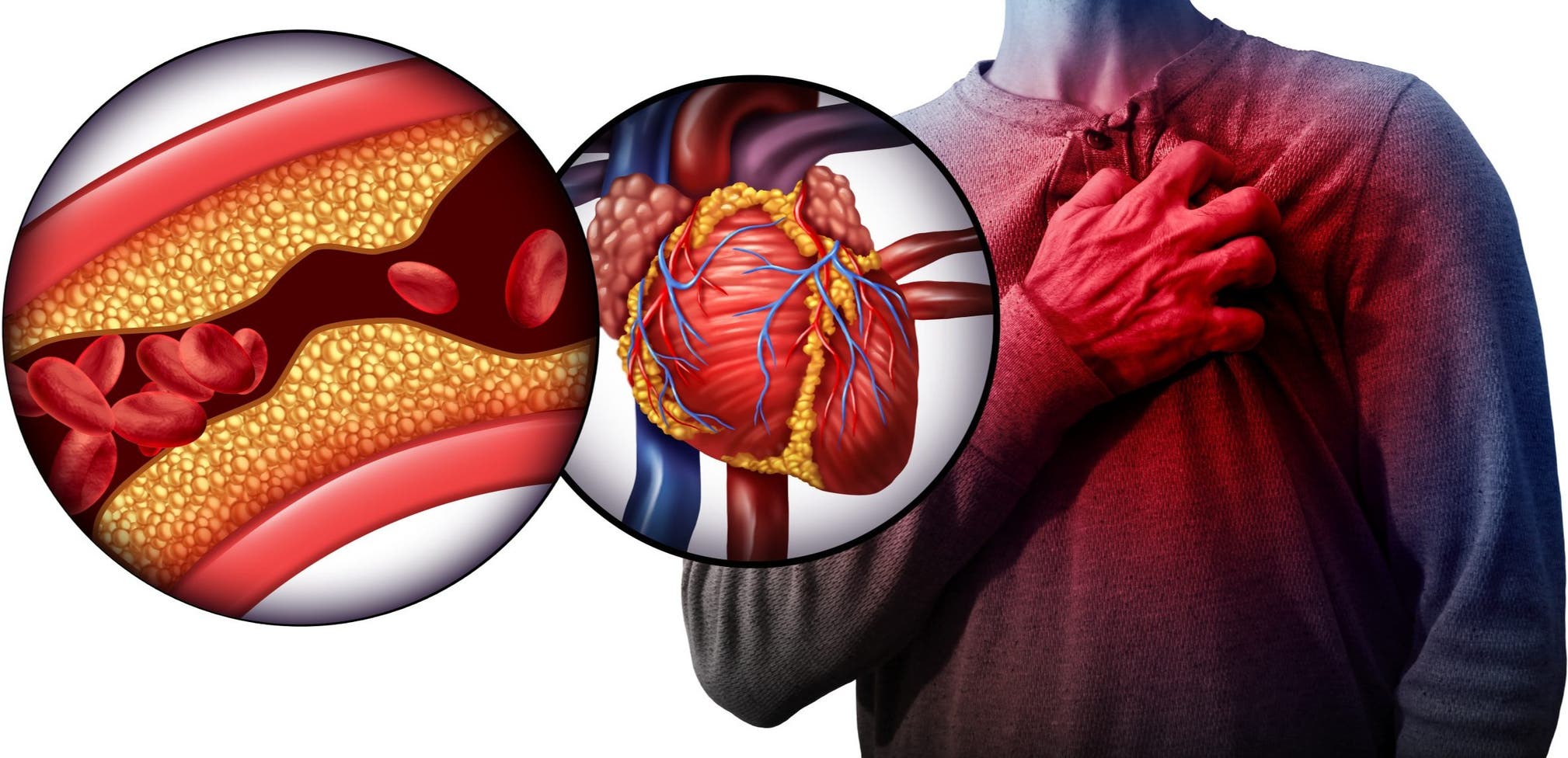 Groundbreaking treatment for heart disease uses lasers to vaporize ...