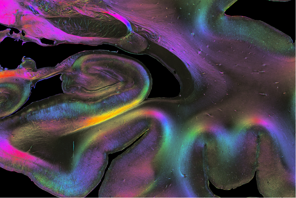 Researchers solve the mystery of how different brain regions are ...