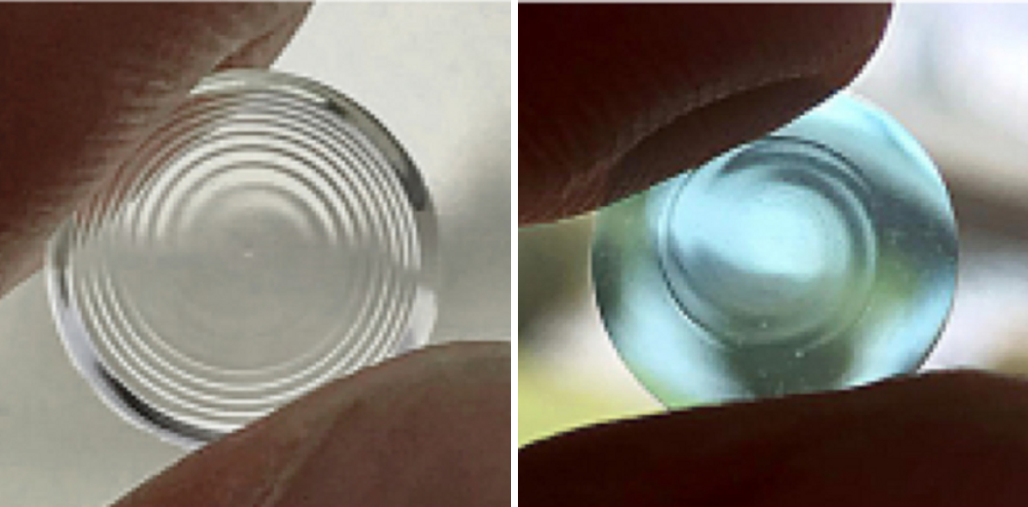 Spiral-shaped lenses revolutionize cataracts and vision treatment - The ...
