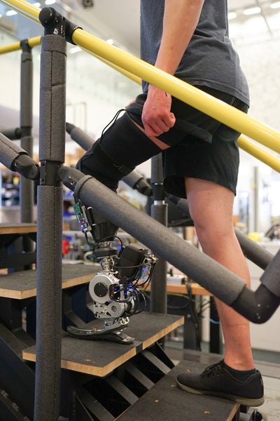 The first brain-controlled bionic leg revolutionizes mobility for amputees - The Brighter Side ...