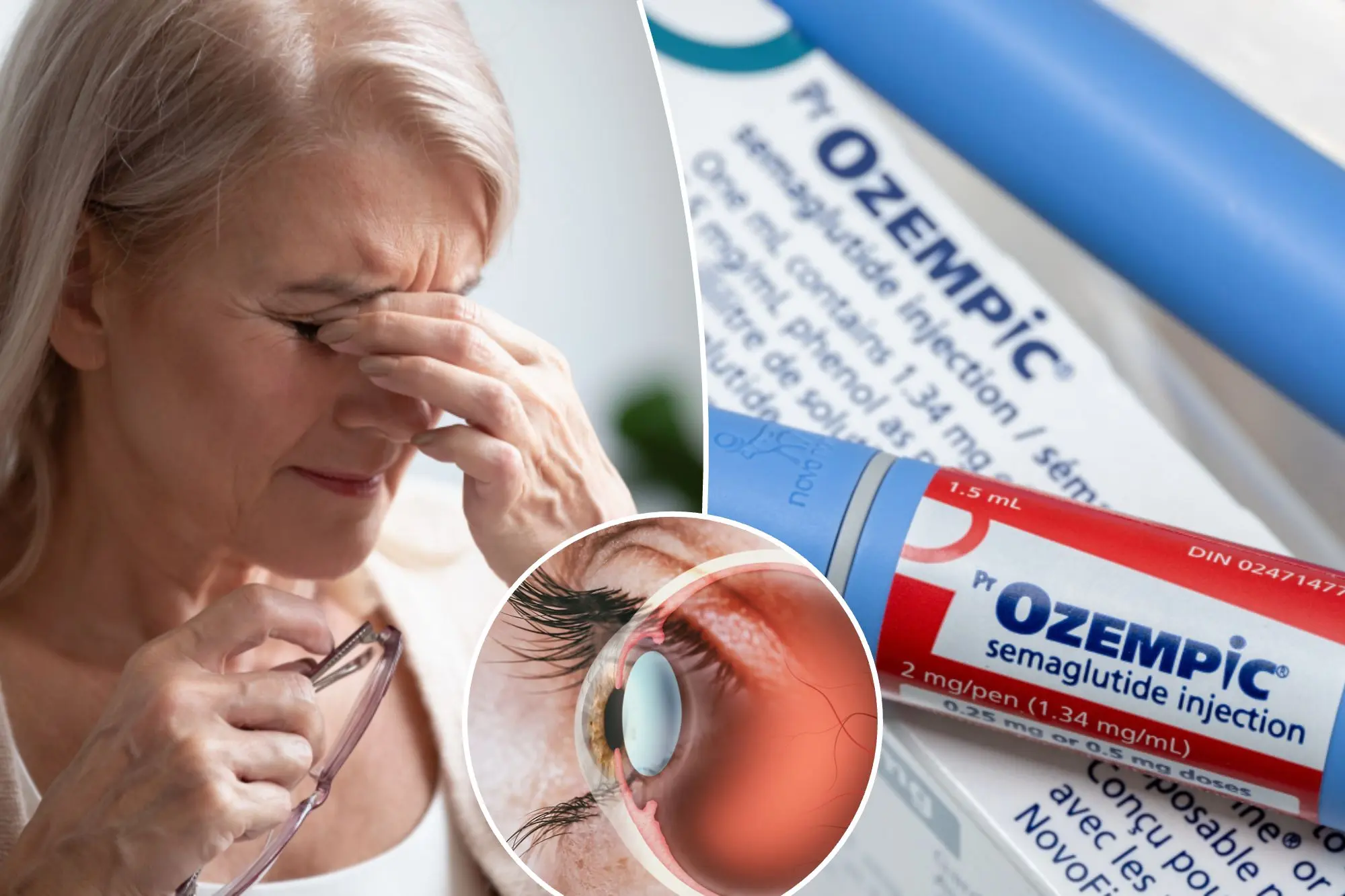 Study reveals potential eye risk for Semaglutide (Ozempic) users - The ...