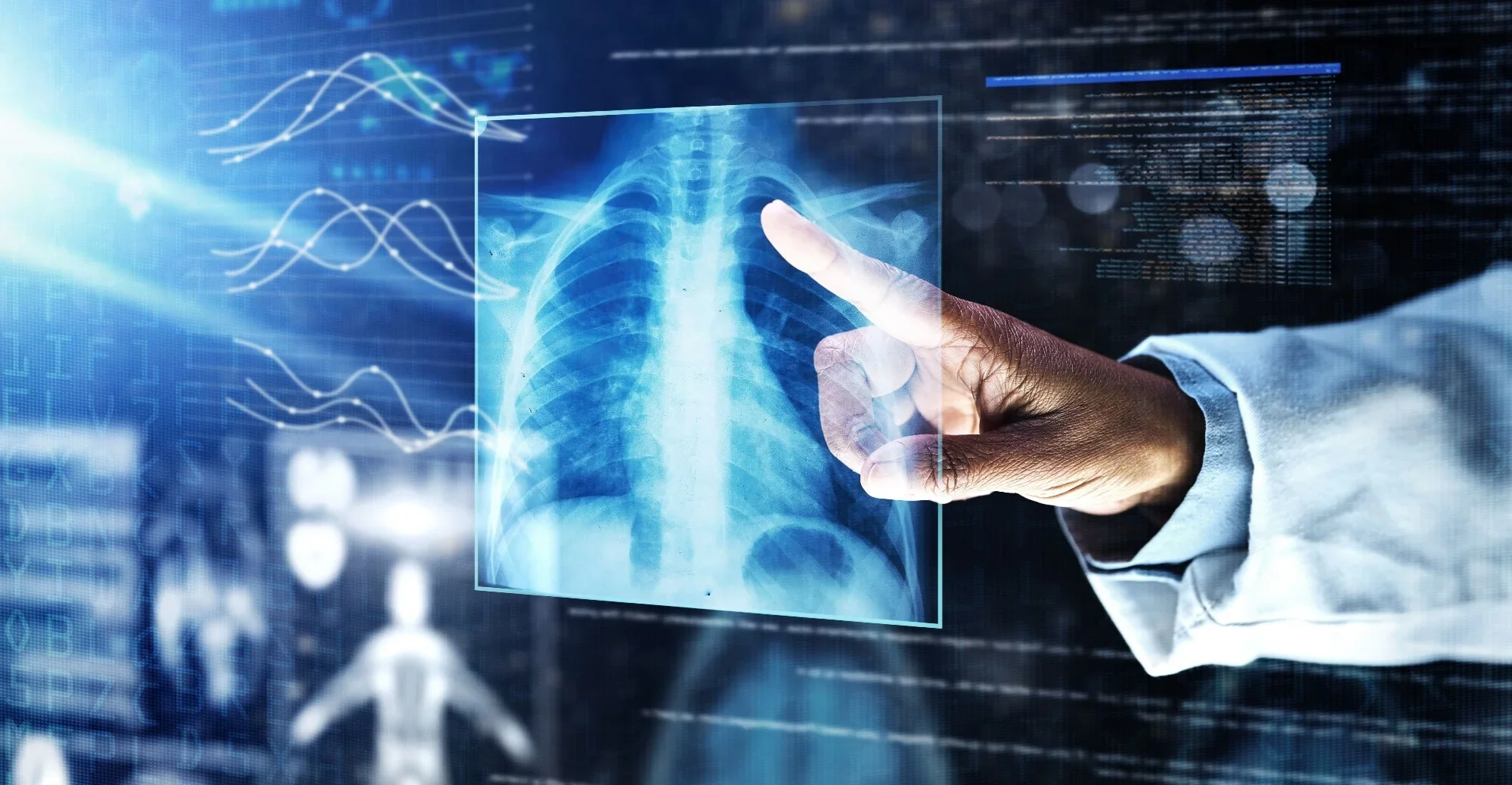 Cutting-edge AI platform significantly improves lung cancer diagnosis ...