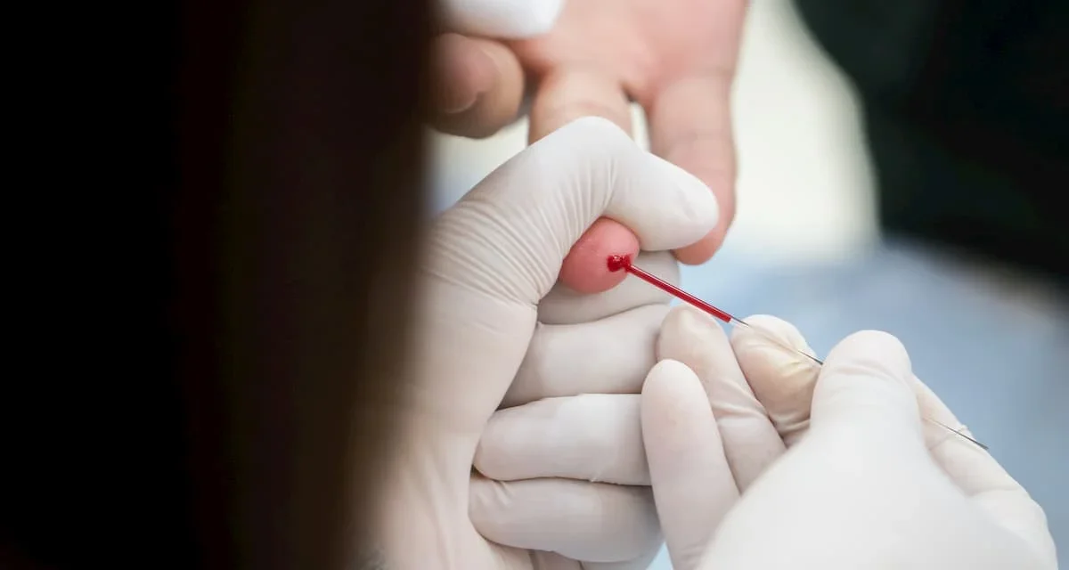 New technology eliminates finger-sticks for blood samples - The ...