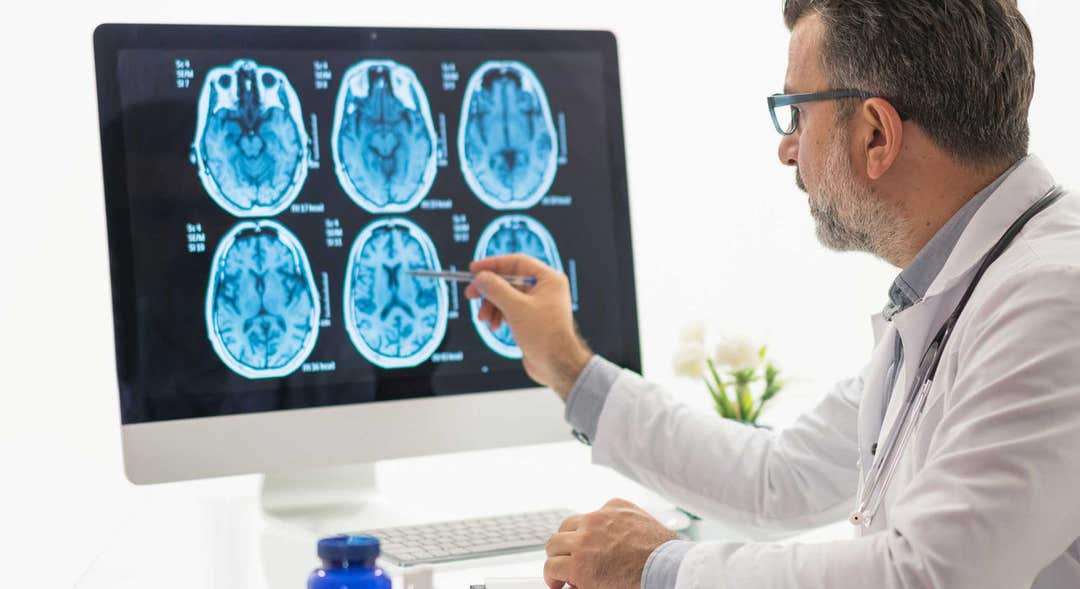 AI breakthrough offers non-invasive brain cancer screening - The ...