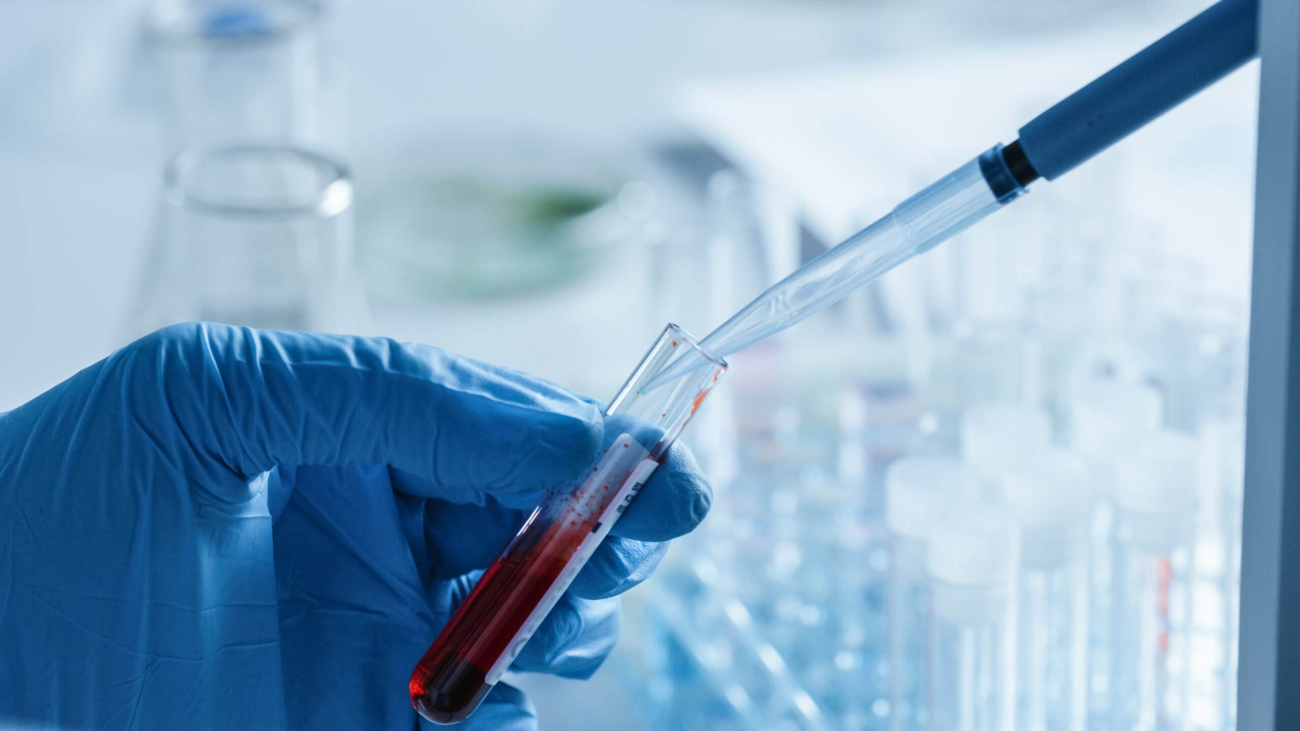 Major breakthrough unlocks scalable artificial blood production - The ...