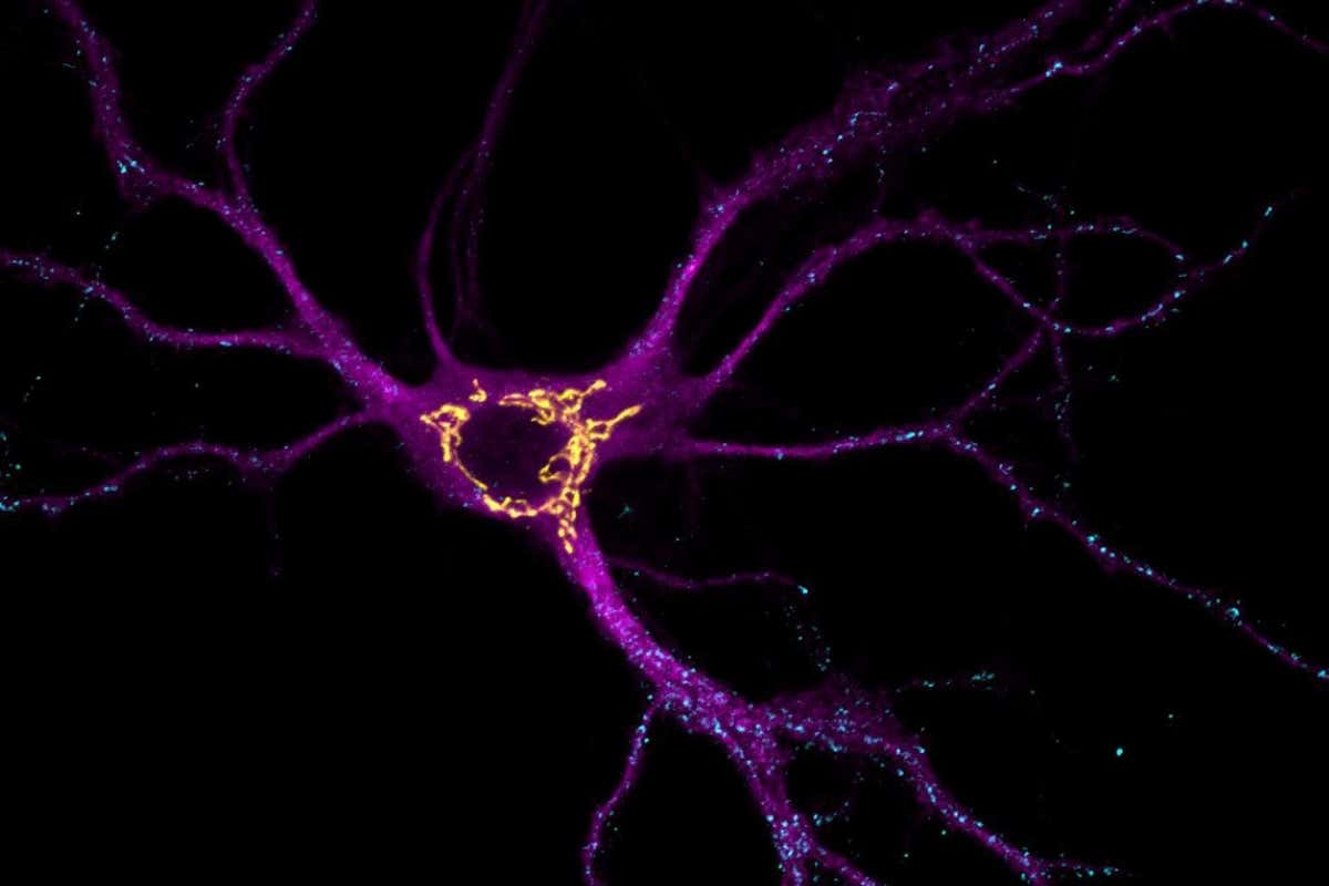Neurons burn fat to keep your brain running and fight disease - The ...
