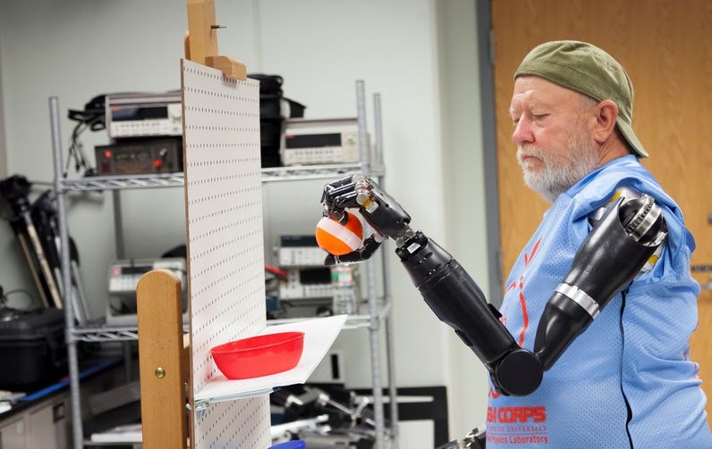 Next-gen bionic arms read nerve signals years after amputation - The ...